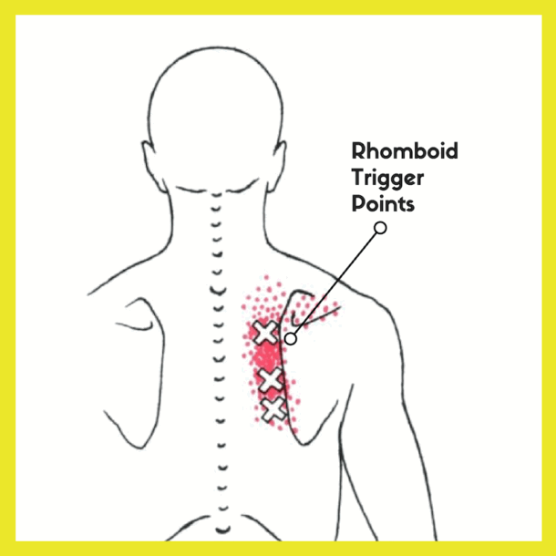 Shoulder pain - rhomboid muscles - Complete Calm Massage Therapy